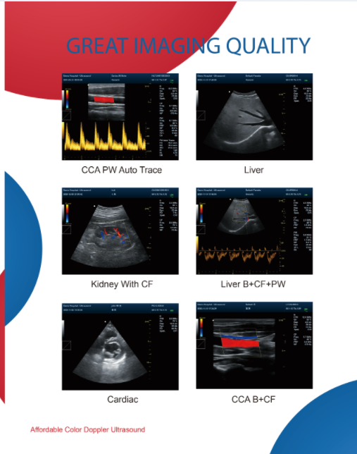 Cardiology Color Doppler Ultrasound Scanner Phased Array Probe CMS1700B ...
