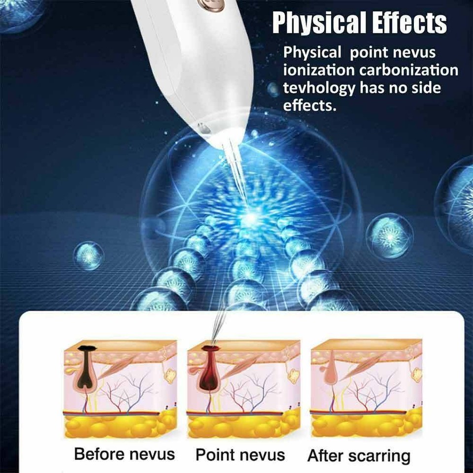 Laser Plasma Pen Freckle Remover Machine LCD Skin Mole Wart Dark Spot ...