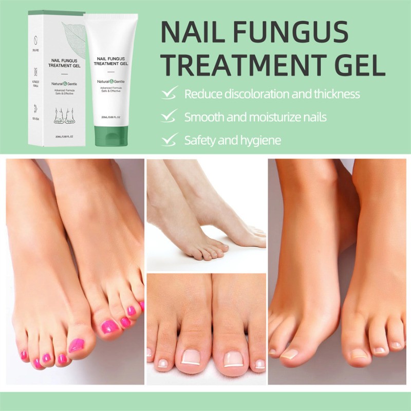 2025 Nutraboost Nail Fungus Treatment Gel, Nail Fungus, Fungus Cream ...