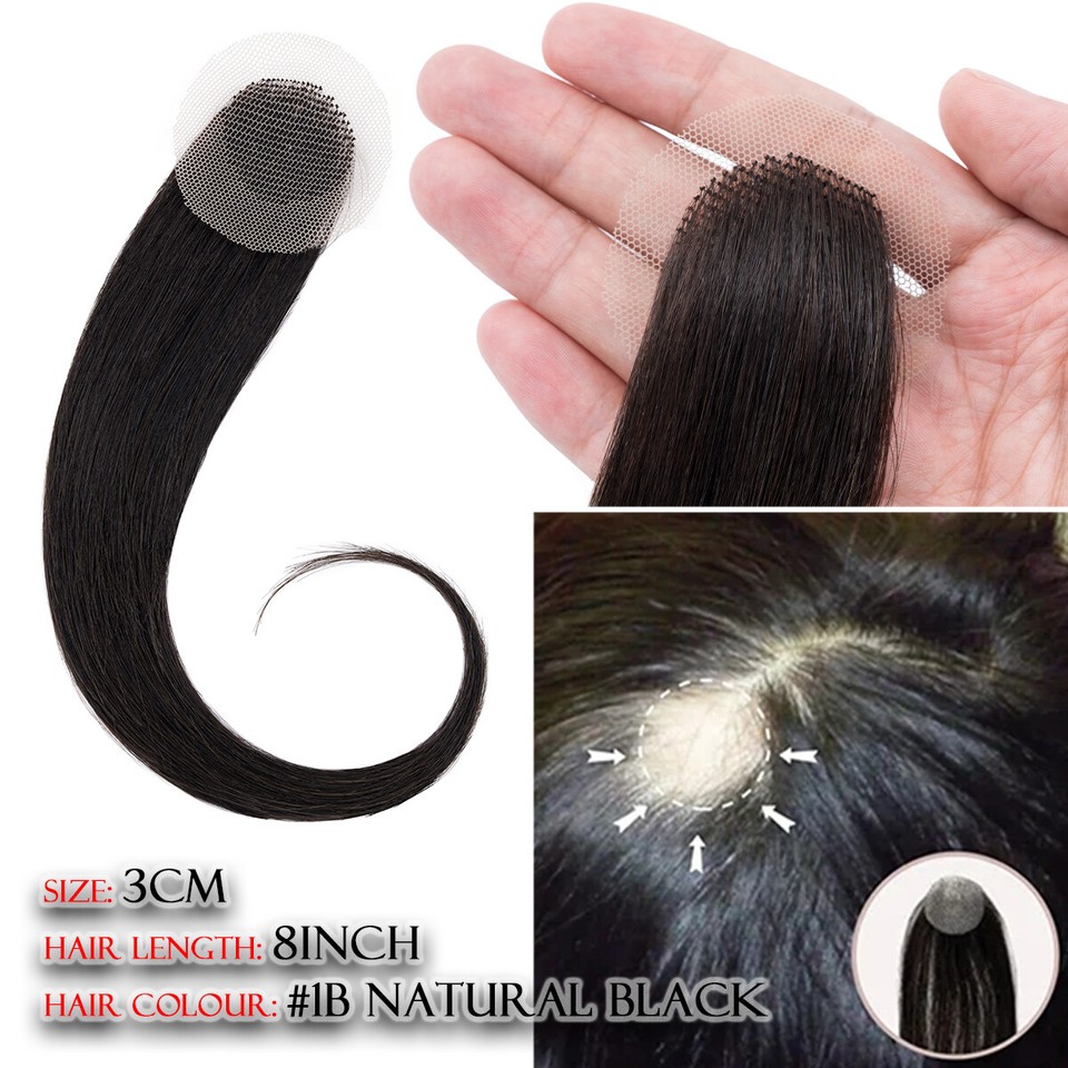 Lace Cover-up 100% Remy Human Hair Patches Piece for Alopecia Areata ...