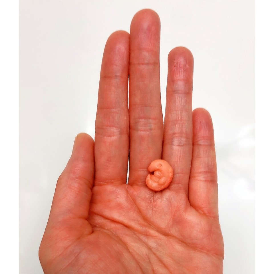 4 Week Gestation Embryo, Stage of Fetal Development (Keepsake, Baby ...