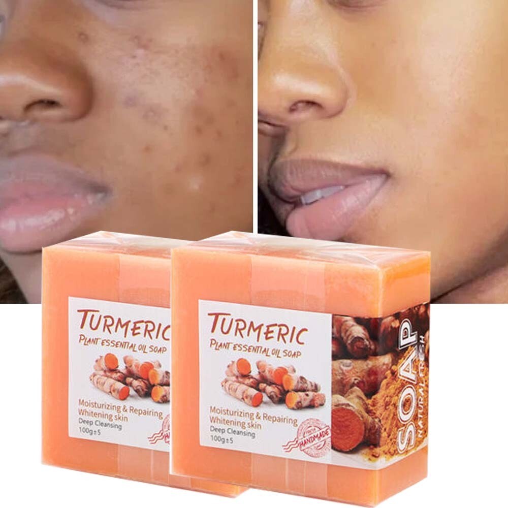 Turmeric Soap Skin Whitening Dark Spots lightening Acne Brightening ...