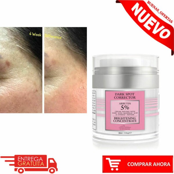 Crema Blanqueadora De Hidroquinona Aligerante Al 5 Desvanecimiento.de ...