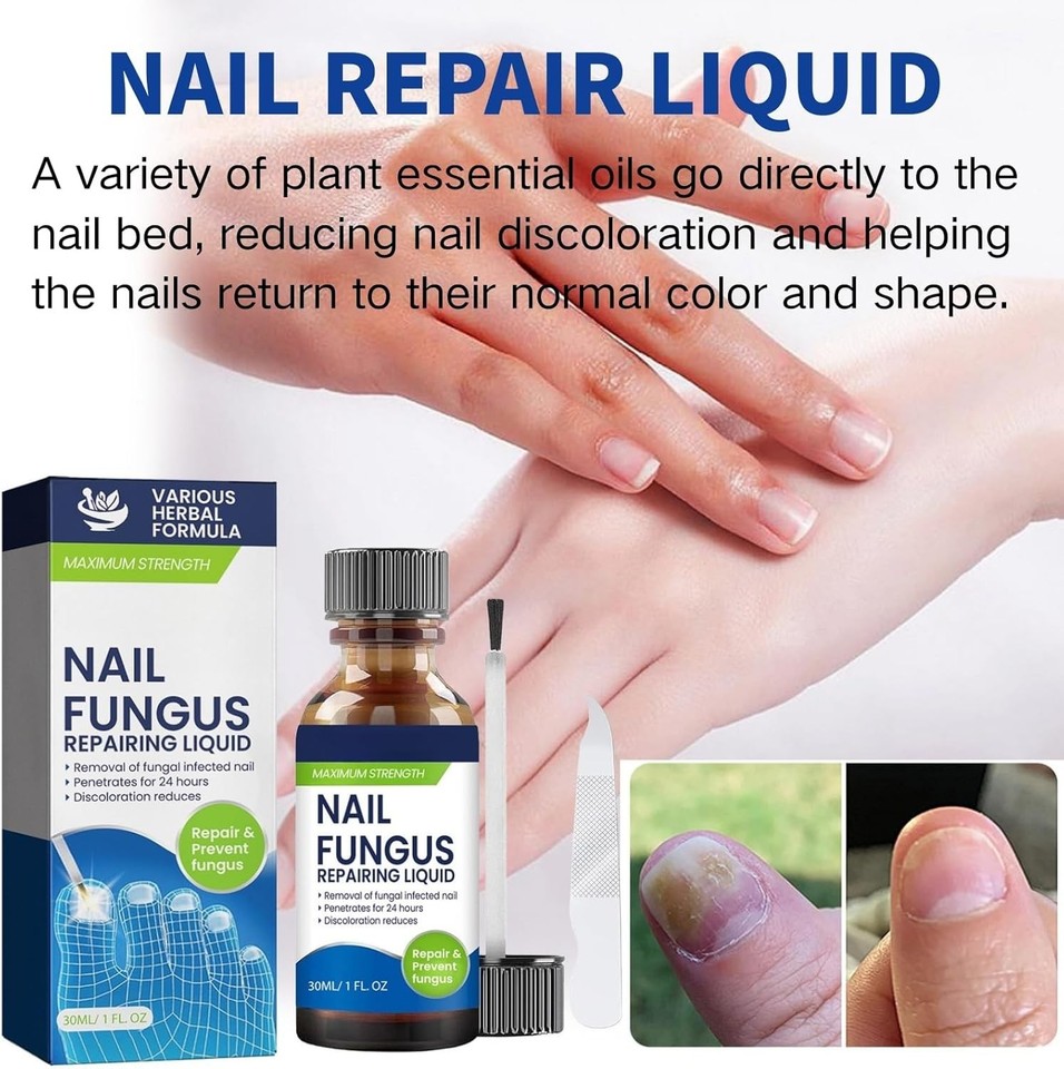 Fungus Nail Treatment Set Toenail Repair Kit With Anti Nail Liquid ...