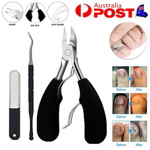 Toe Nail Cutter Clipper Nipper Chiropody Fungus Ingrown Scissors Tool ...