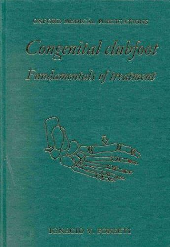 Congenital Clubfoot : Fundamentals for Treatment by Ignacio Ponseti ...