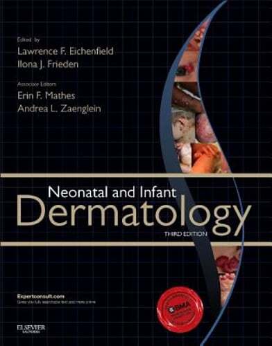 Neonatal and Infant Dermatology by Lawrence F Eichenfield: New ...