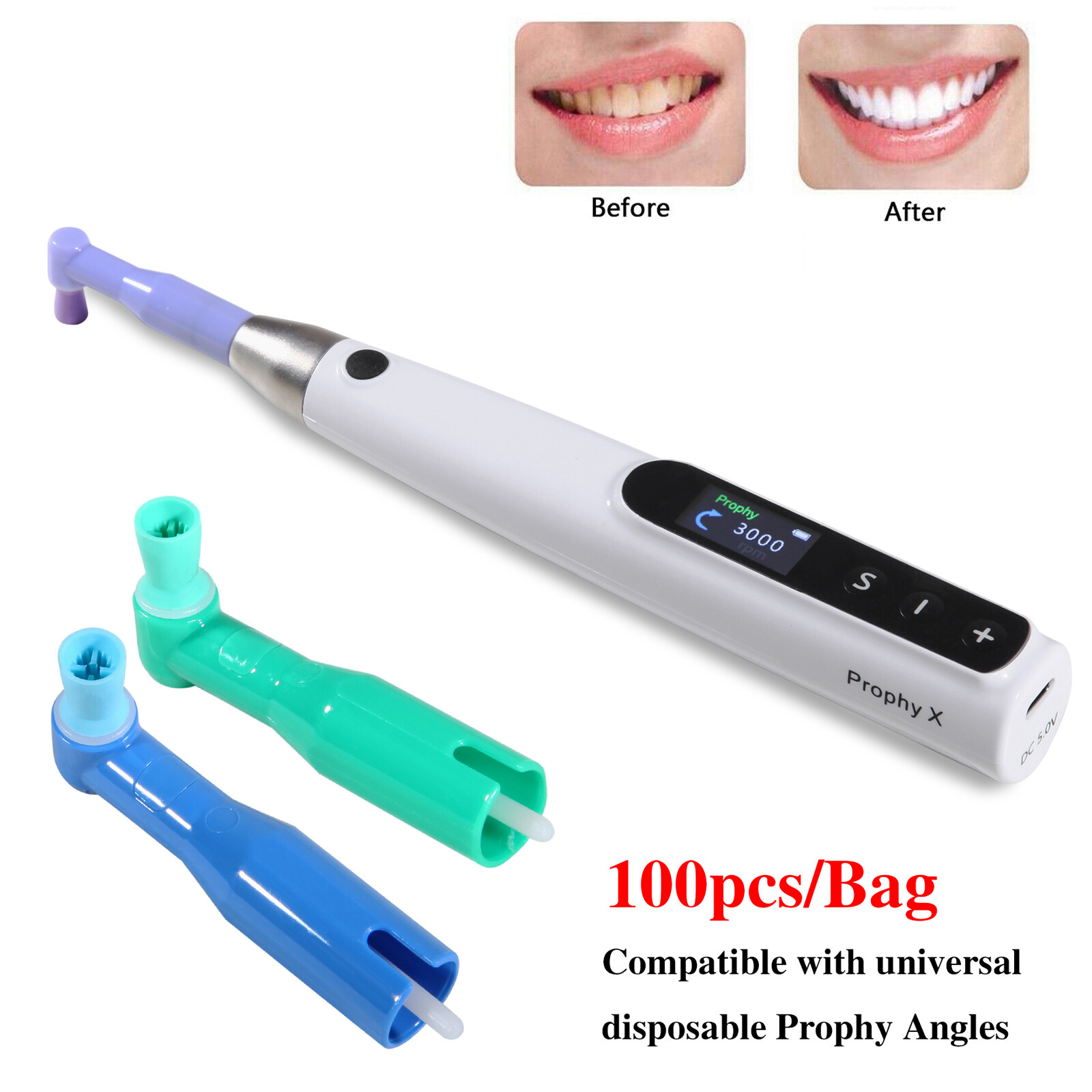 Dental Hygiene Prophy Handpiece Wireless Cordless /100PCS prophy angles ...
