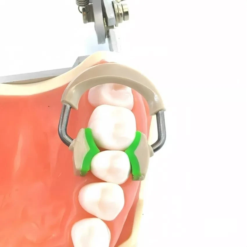 Dental Fit Garrison Palodent System Matrix Bands Ring Sectional Matrice ...