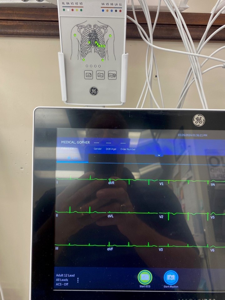 GE CAM Connect 14 Module 2091686-001 Biomed Tested on Mac Vue360 with ...