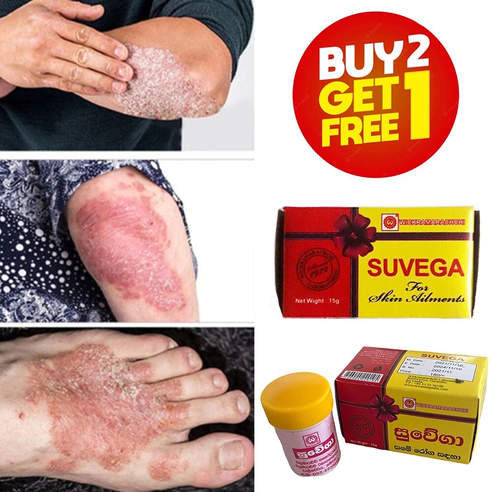 Heat Rash Treatment Cream