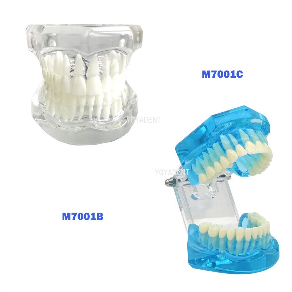 Teeth Model Dental Typodont Ortho Implant Pathological Perio Practice ...