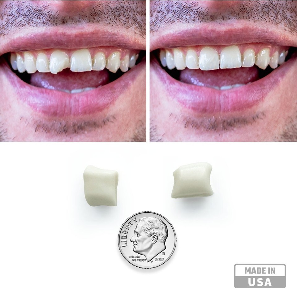 Imako® Tooth Tinted Plastic - Temporary Tooth - Fix Chipped Teeth, Gaps ...