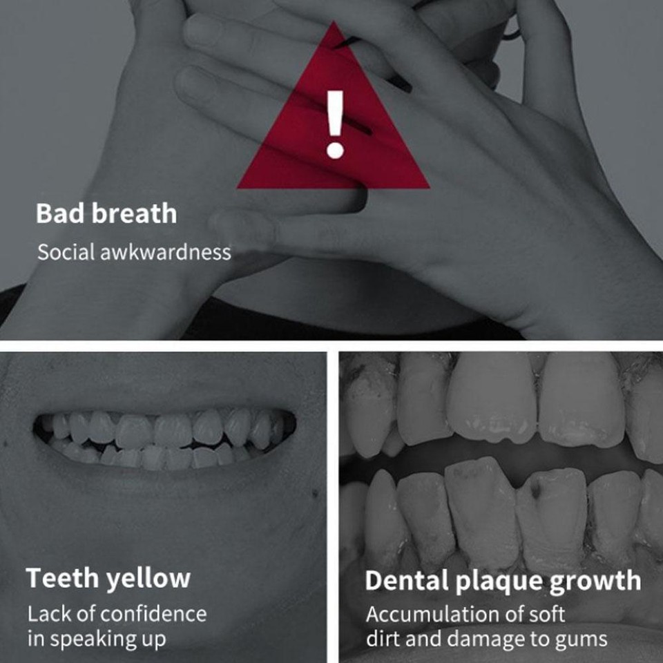 Sp10 Probiotic Toothpaste, Sp 10 Probiotic Toothpaste Whitening 100G 丨 ...