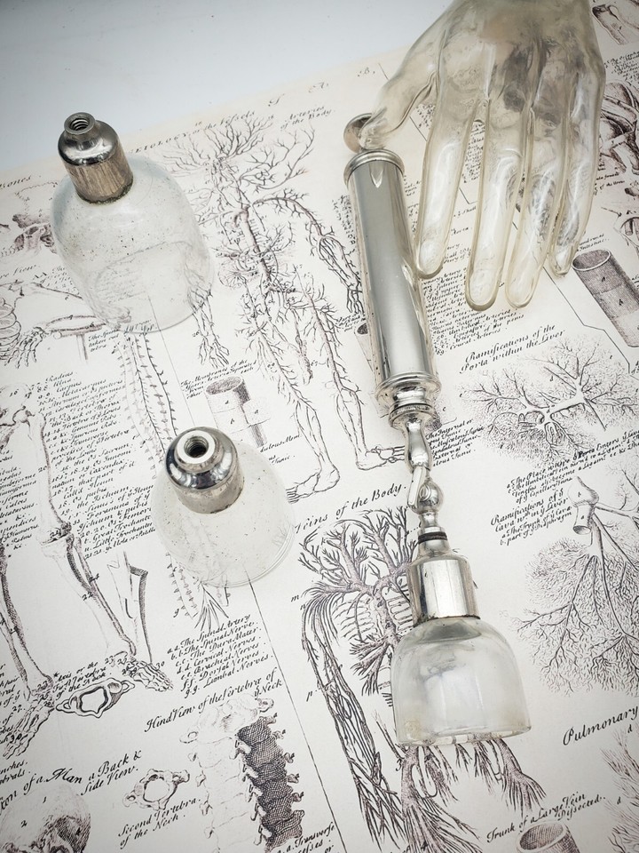 ANTIQUE MEDICAL SURGICAL BLOODLETTING CUPS SYRINGE RARE ODDITIES BLOOD ...