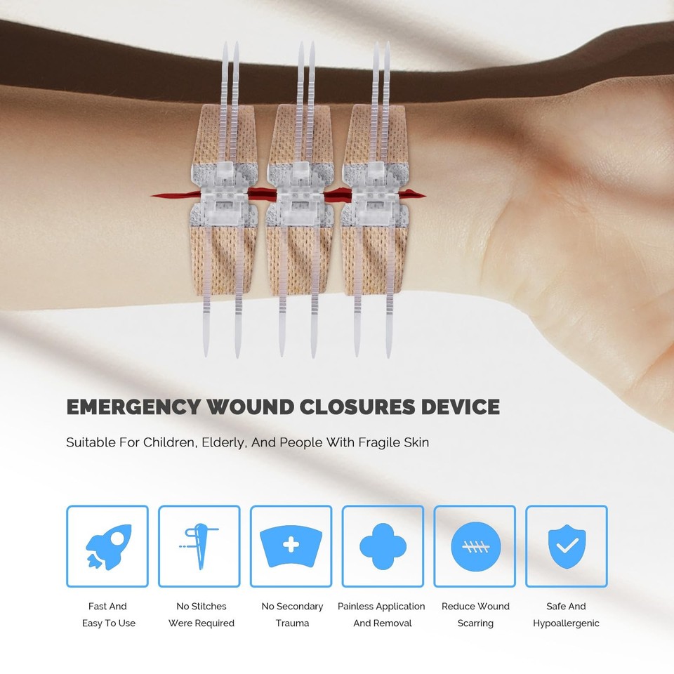 5pcs Zip Stitch Wound Closure Device, Quick Clot, Outdoor Laceration ...