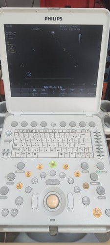 Philips CX50 Ultrasound System With S5-1 Adult Cardiac probe | eBay