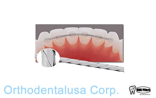 3-Strand Flat Lingual Retainer Wire - 010"x028" 60 inch spool SS ...