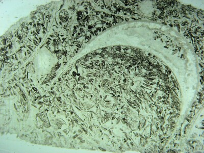 Devonian Ostracod rich Limestone Thin Section microscope slide Hamar ...