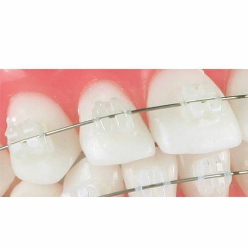 Morelli Dental Orthodontic Ceramic Aesthetic Brackets Braces Case 20pcs ...