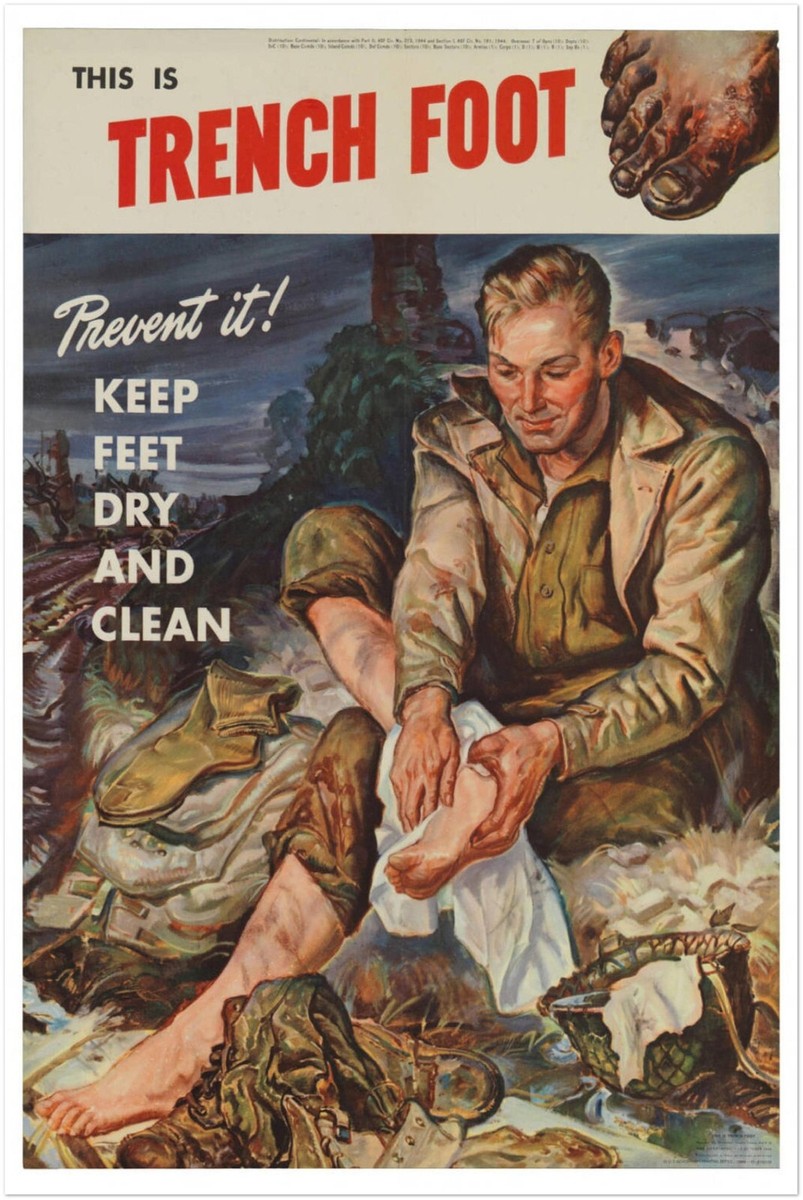 World War 1 Trench Foot TRENCH WARFARE In Your Own Words … Describe