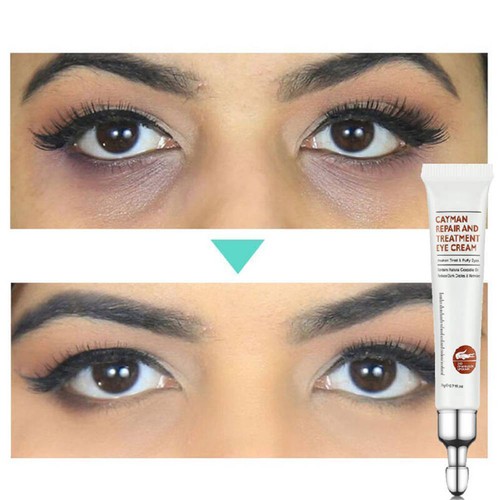 Magic Eye Cream-28 Seconds to Remove Eye Bags / Dark Circles / Eye ...