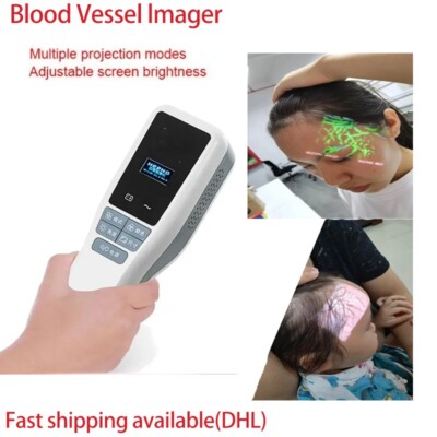 Vein Finder Locator Handheld Portable Infrared Blood Vessel Display ...