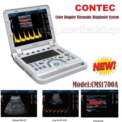 Imaging & Aesthetics Equipment - Transrectal Probe