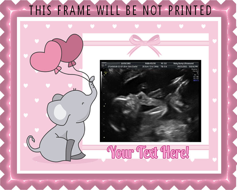 Baby Shower With Ultrasound