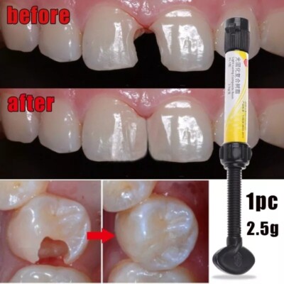 Teeth resin Curing Material Dental Cement Tooth repair filling cavity ...