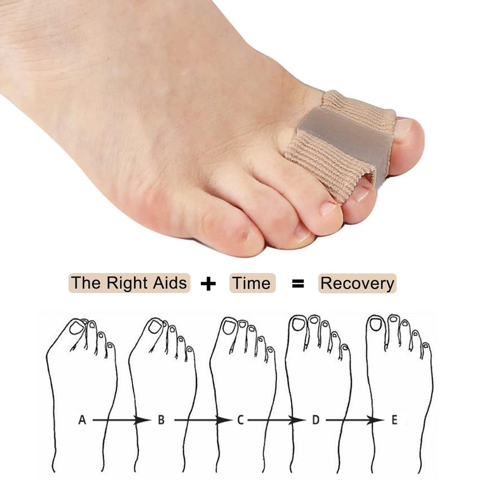 2Pcs Toe Separator Toe Corrector For Women Men Big Toe Spacer Pain ...