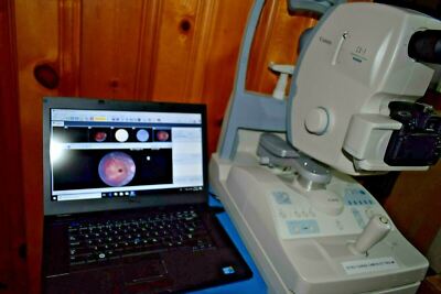 Canon CX-1 Fundus retinal camera non-myd/mydriatic FAF Fluorescein FFA ...