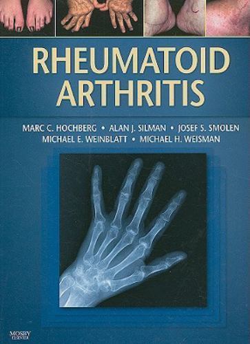 Rheumatoid Arthritis by Alan J. Silman, Michael E. Weinblatt, Michael H ...