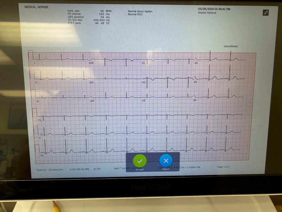 GE CAM Connect 14 Module 2091686-001 Biomed Tested on Mac Vue360 with ...