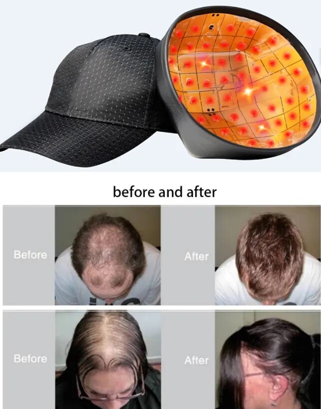 FDA Cleared Hair Growth Laser Cap 208 LED Diodes Hat Rejuvenation ...