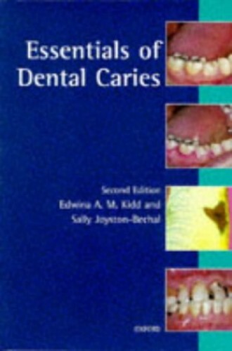 Essentials of Dental Caries: The Di..., Joyston-Bechal, | eBay.de
