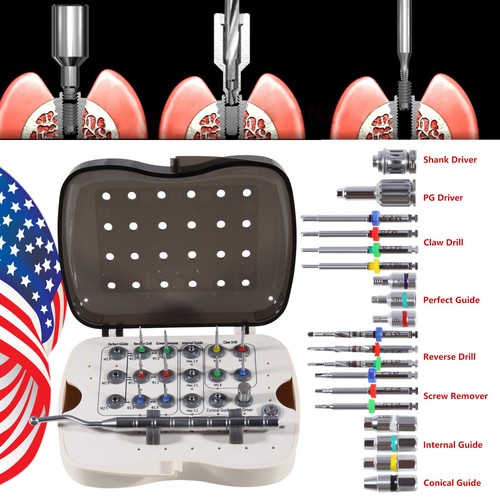 Dental Implant Screw Removal Kit Neobiotech SR Repair Tool Universal | eBay