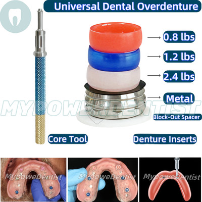 Dental Abutment Attachments Locator Inserts Caps/Remove Locator Core ...