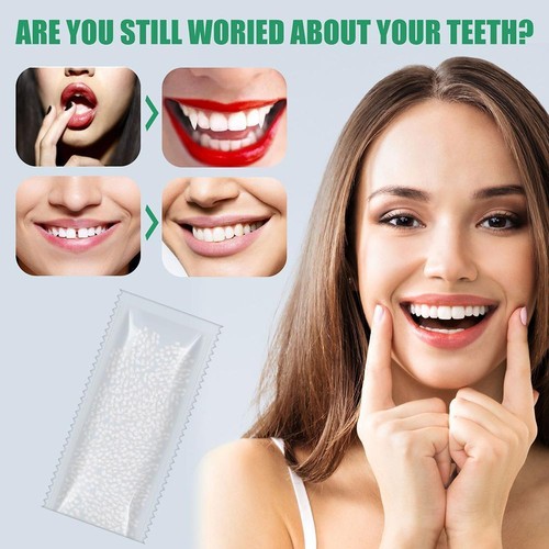 Temporary Tooth Repair Beads Broken Teeth Filling Material Temp Replace ...