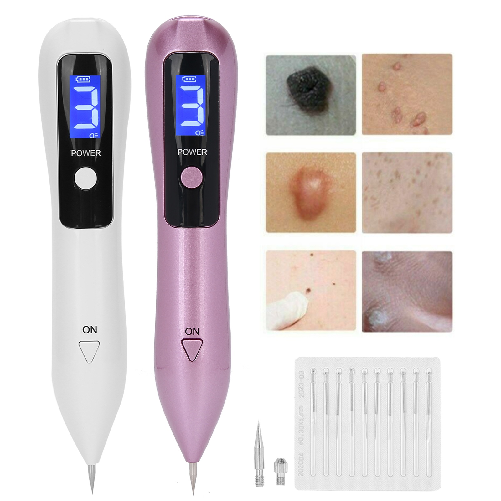 Laser Plasma Pen Wart Spot Remover Mole Freckle Tattoo Removal Machine ...