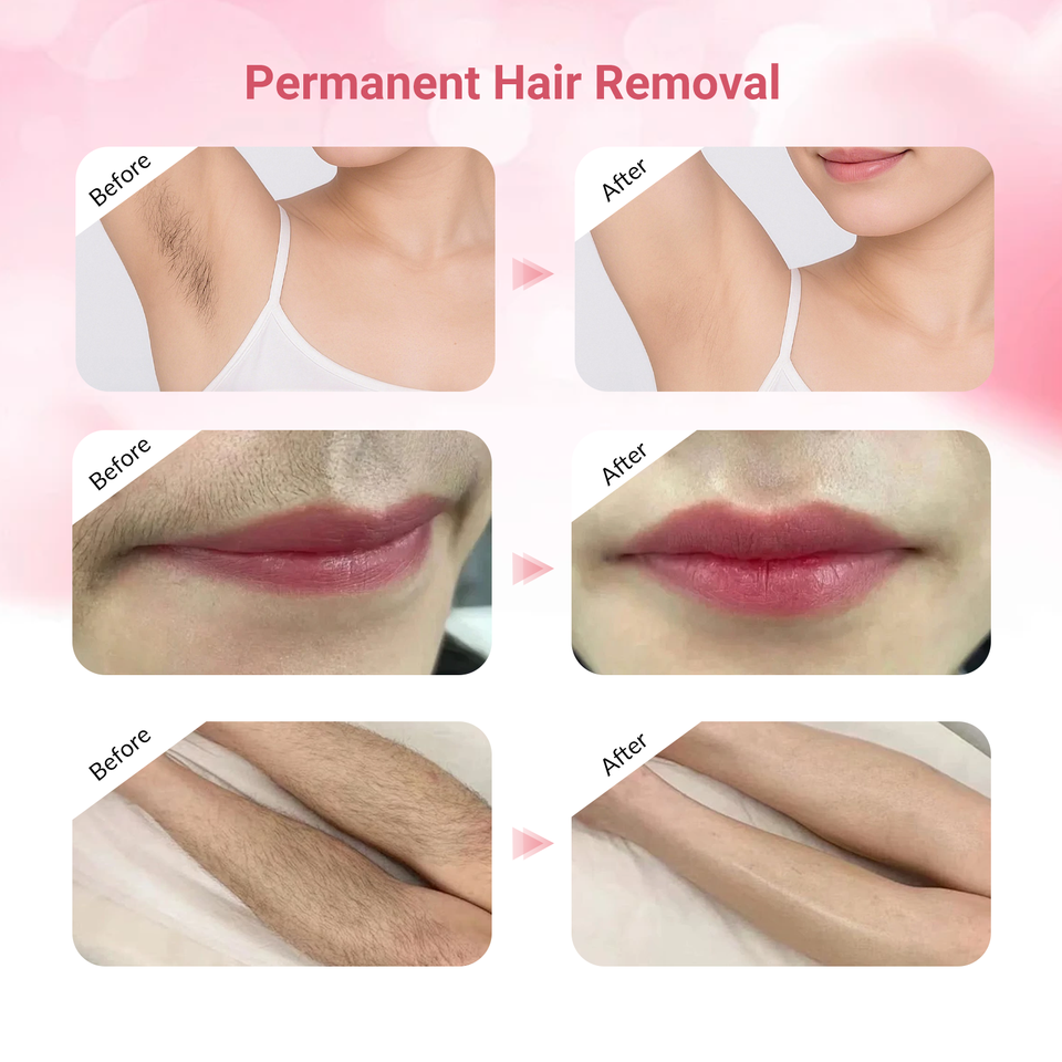 3 In 1 IPL Epilator Hair Removal Machine Ice Cooling Permanent Home Use ...