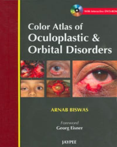 Color Atlas of Oculoplastic and Orbital Disorders by Arnab Biswas (2008 ...
