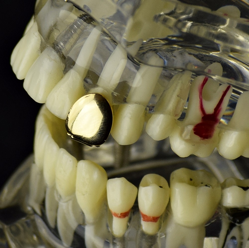 14k Gold Plated Single Cap Grillz Plain K9 Canine Teeth One Top Premade ...