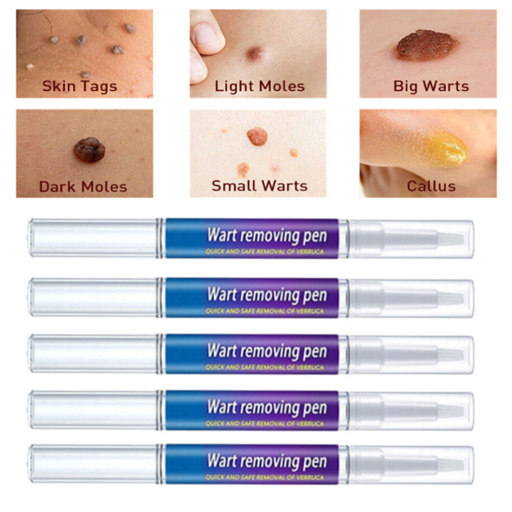 5 PACK Skin Tag Remover Pen Skin Tag Mole Wart Dark Spot Remover ...