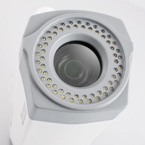 RCS-400 Electronic Colposcopy Colposcope High Resolution Vaginal Camera ...