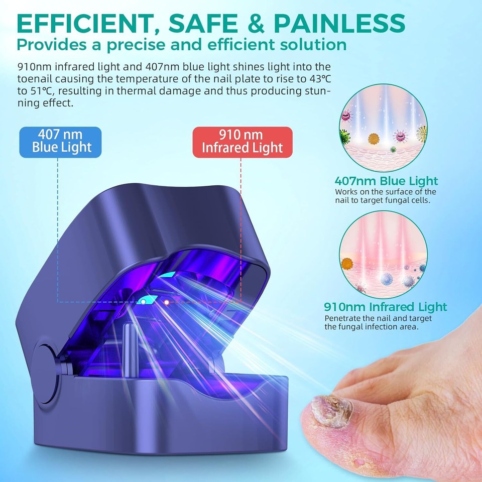 Anti Fungal Laser Device Finger Toe Nail Fungus Remover Onychomycosis ...