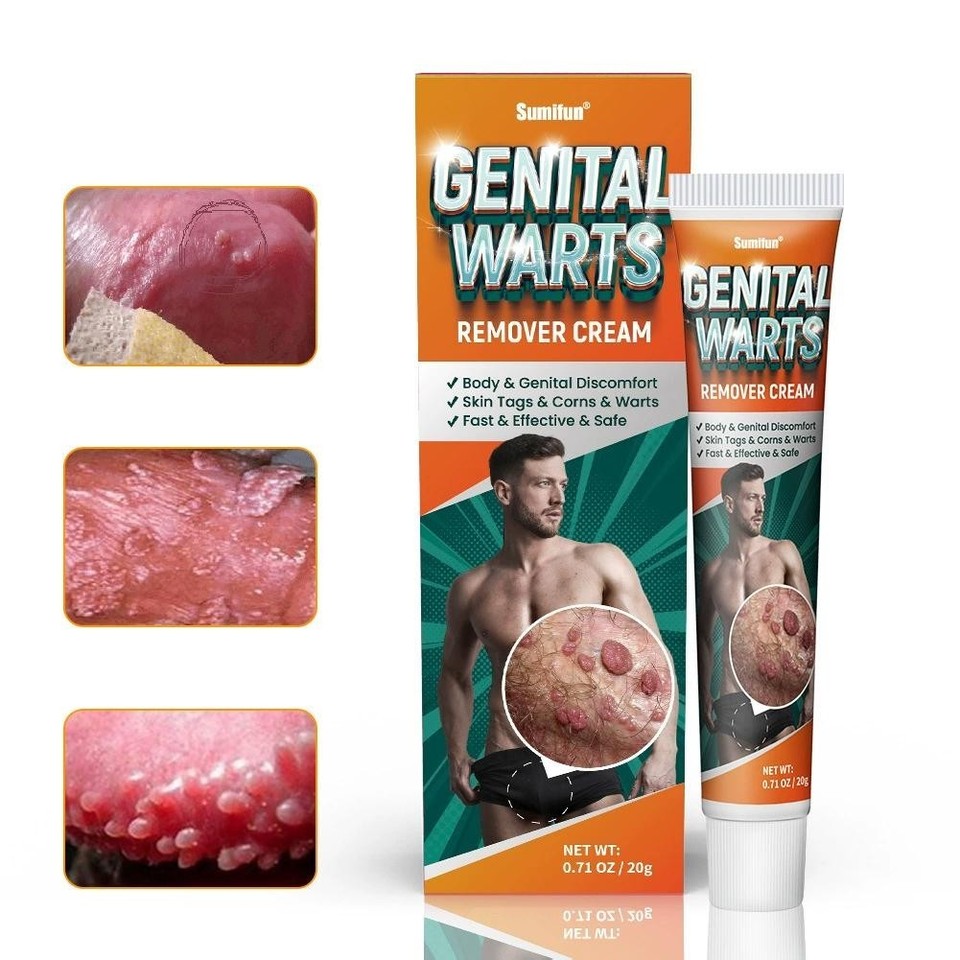 .>Genital Warts Remover Cream Body & Genital Discomfort, Skin Tags F8H7 ...
