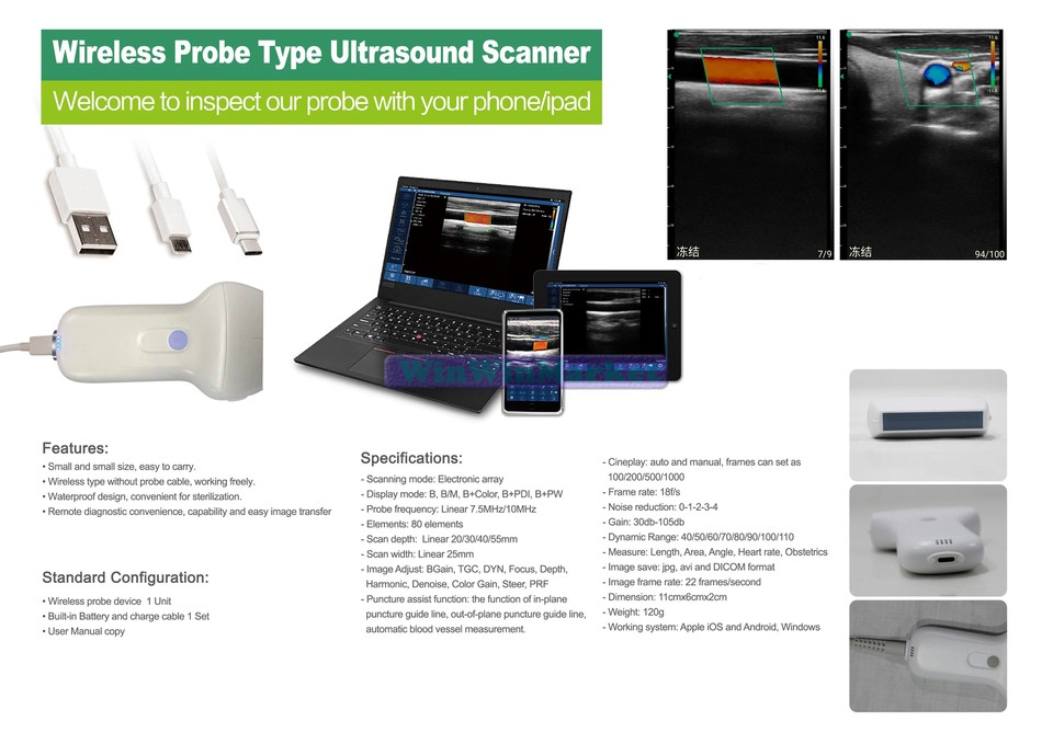 128E Wireless Ultrasound Probe Scanner WIFI Support iOS Android Windows ...