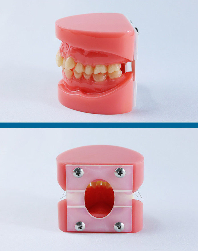 1PC DENTAL TYPODONT MODEL Show Tooth Dislocation Orthodontic ...