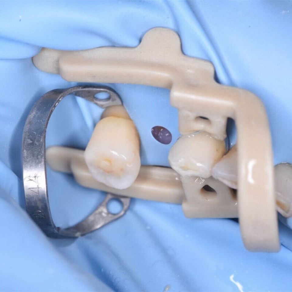 Dental Distal Premolar Clamps Rubber Dam Sheets Clip Soft Resin Clamp ...